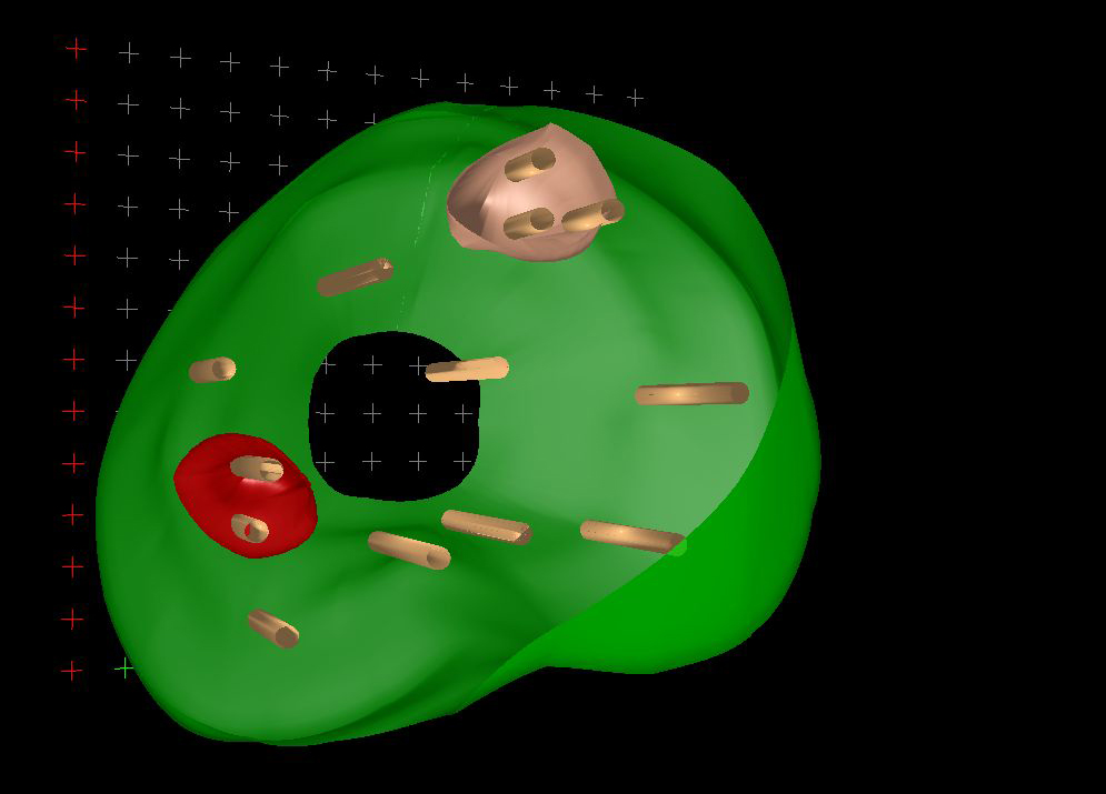 MRI融合標的前立腺生検（MRIフュージョン生検） | 泌尿器科 | 診療科・部門 | 医療法人財団 明理会 東戸塚記念病院